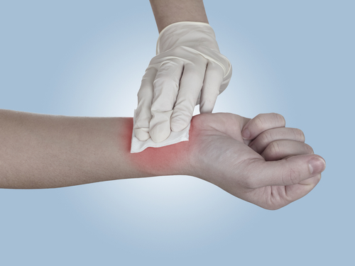 Changing Your Own Dressings: Tips for At-Home Wound Care
