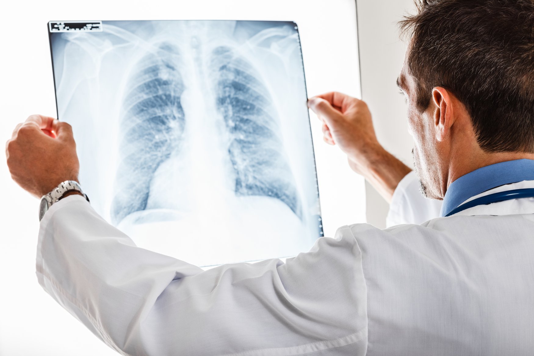 How to Set Goals for Pulmonary Rehabilitation Therapy